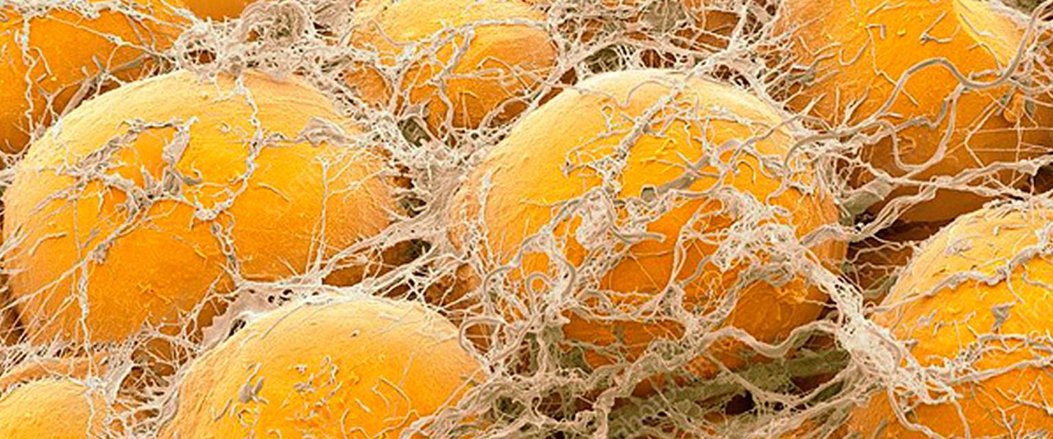 Nanofat Greft (Nano Fat Enjeksiyonu) – Mustafa Durgun